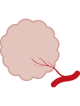 What is MVASI™? | MVASI™ (bevacizumab)