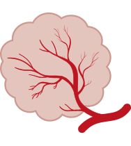 What is MVASI™? | MVASI™ (bevacizumab)